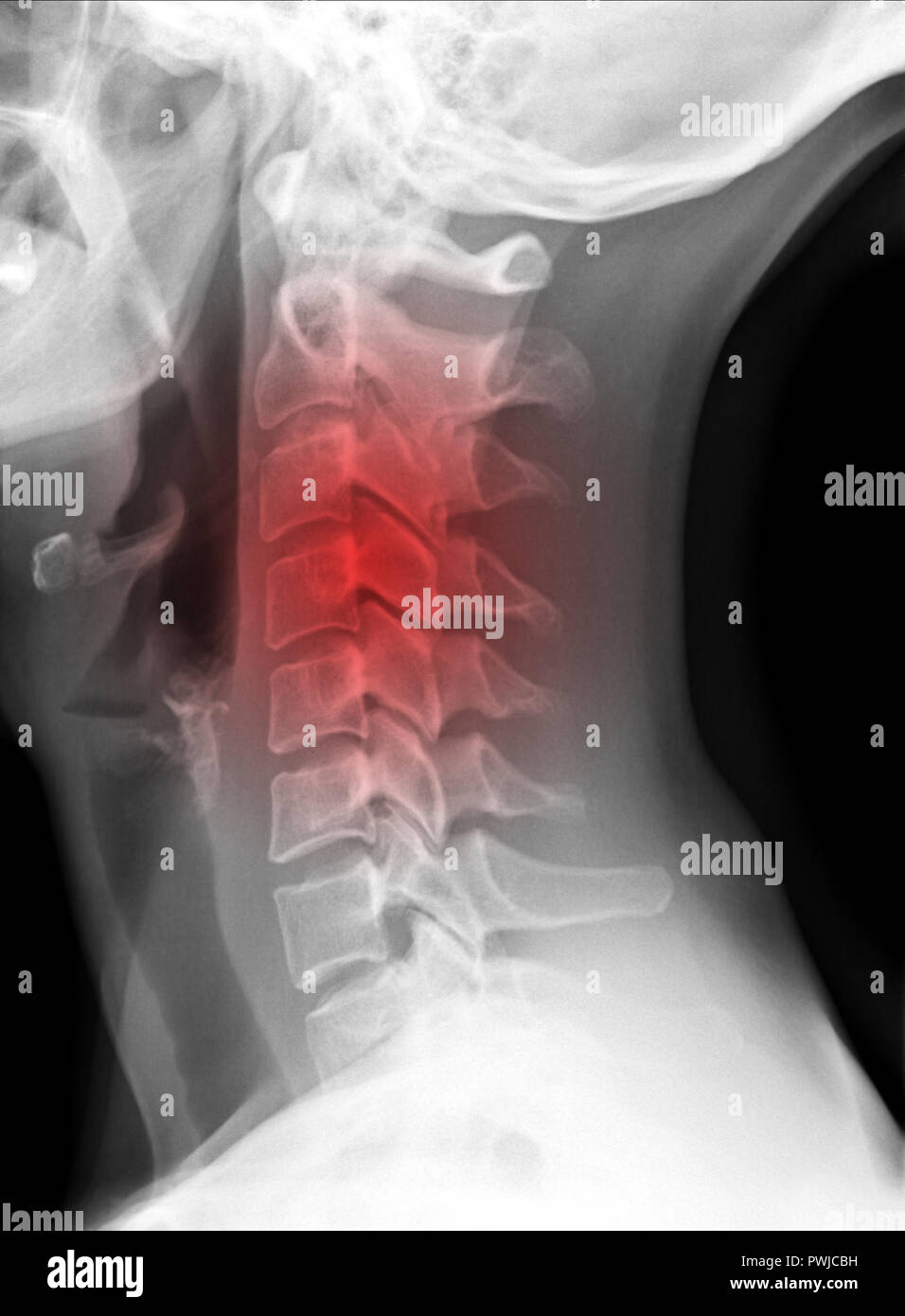 Rückgrat symbol -Fotos und -Bildmaterial in hoher Auflösung – Alamy