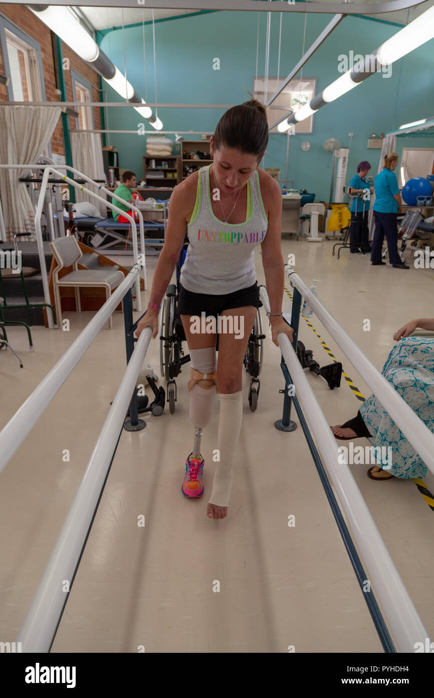 Beinamputiert Frau Stockfotos und -bilder Kaufen - Alamy