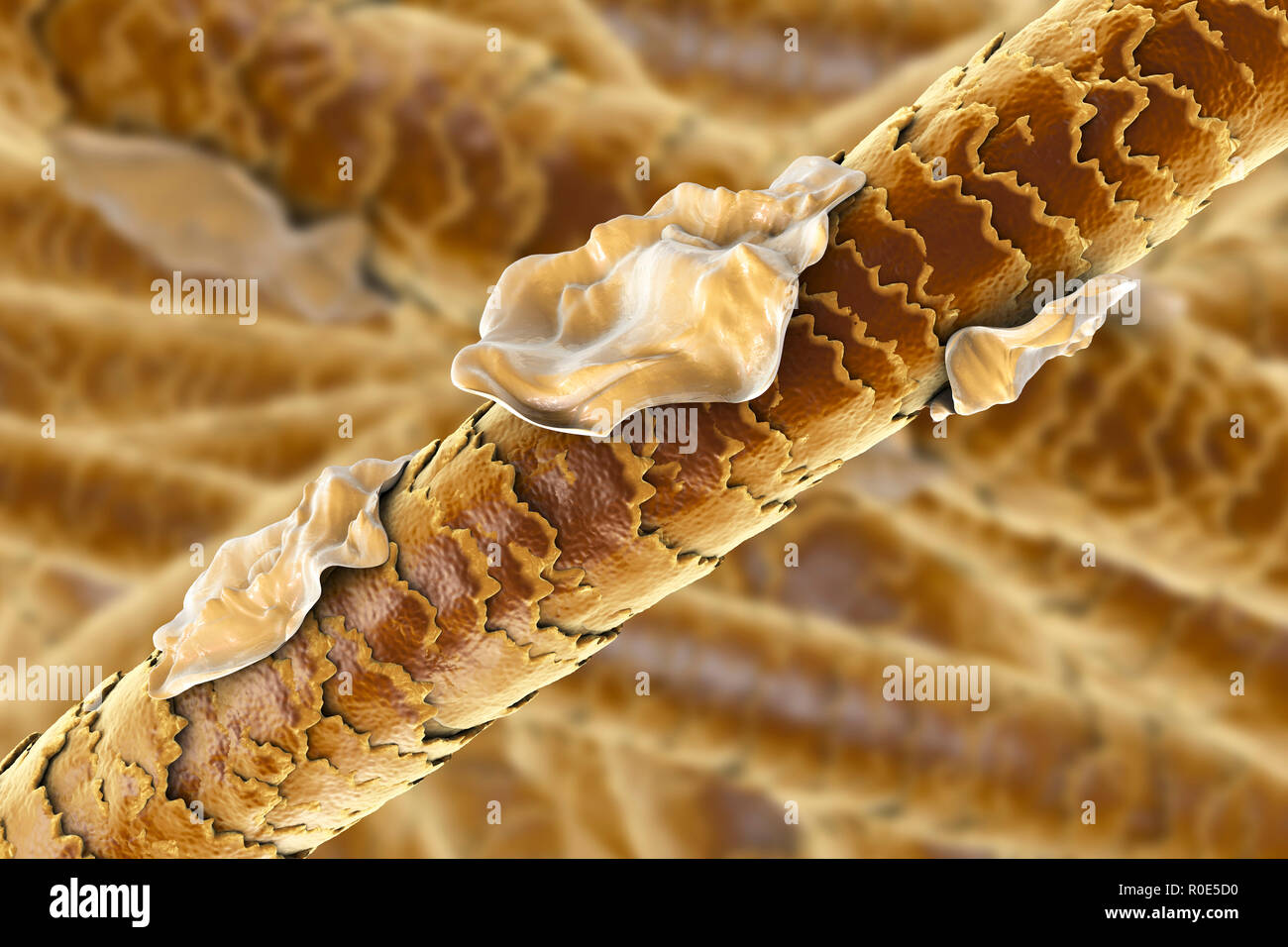 Pityriasis capitis -Fotos und -Bildmaterial in hoher Auflösung – Alamy