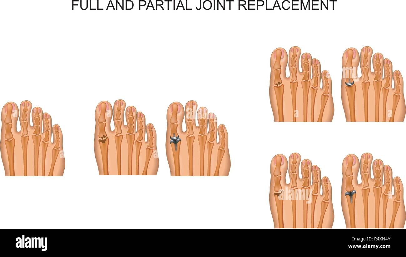 Anatomie bild Stock-Vektorgrafiken kaufen - Alamy