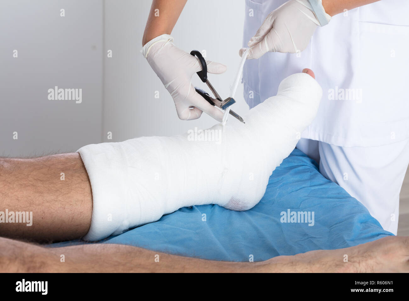 Gipsverband gips arzt wickeln -Fotos und -Bildmaterial in hoher ...