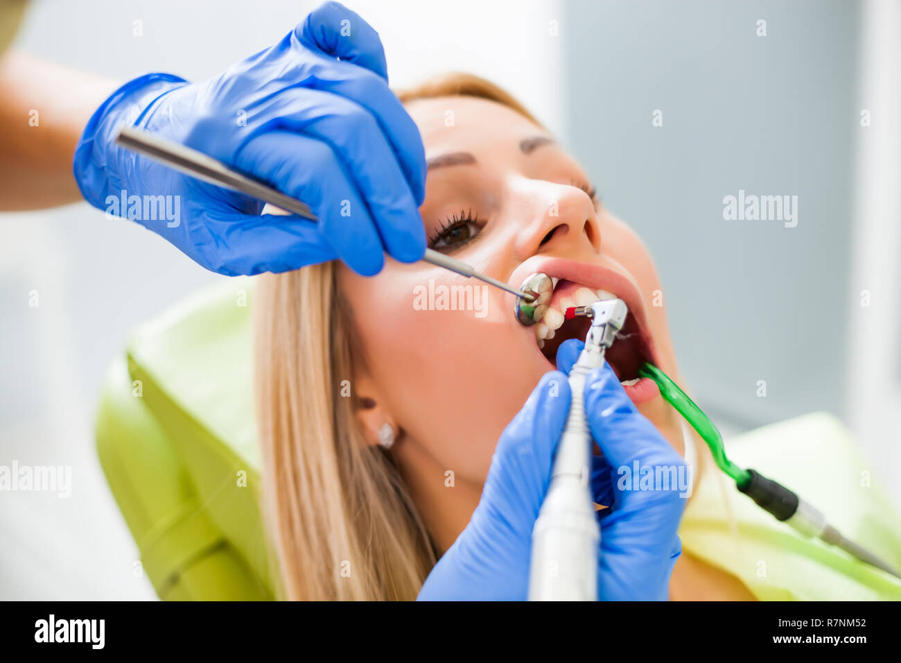 Junge Frau beim Zahnarzt. Zahnarzt ist polieren ihre Zähne Stockfotografie - Alamy