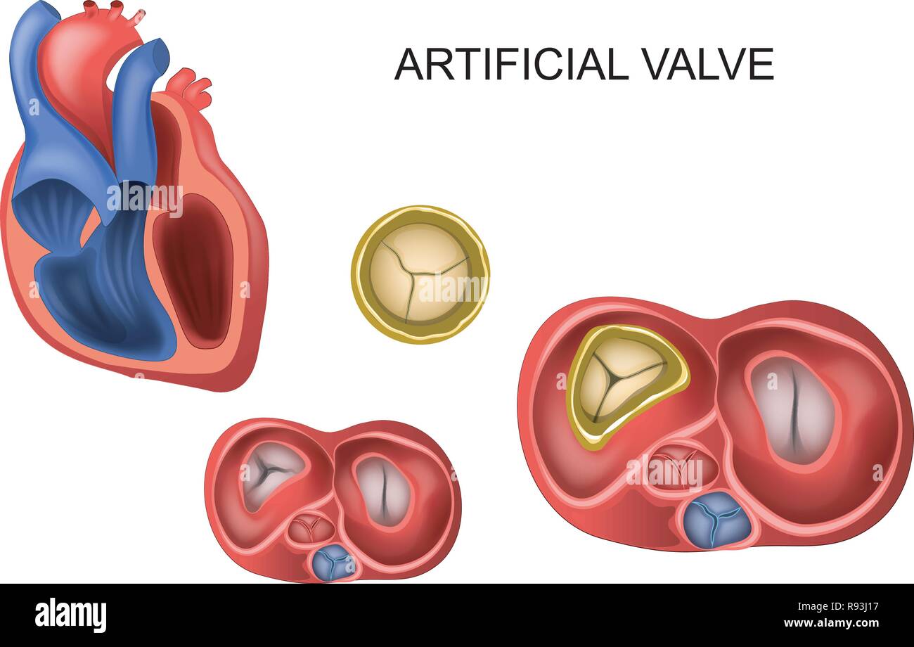 Tricuspid valve -Fotos und -Bildmaterial in hoher Auflösung – Alamy