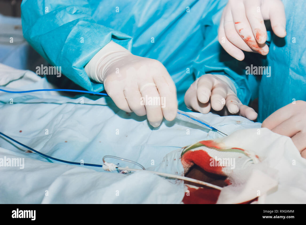 Medizinische team von Chirurgen im Krankenhaus tun minimal-invasiven ...