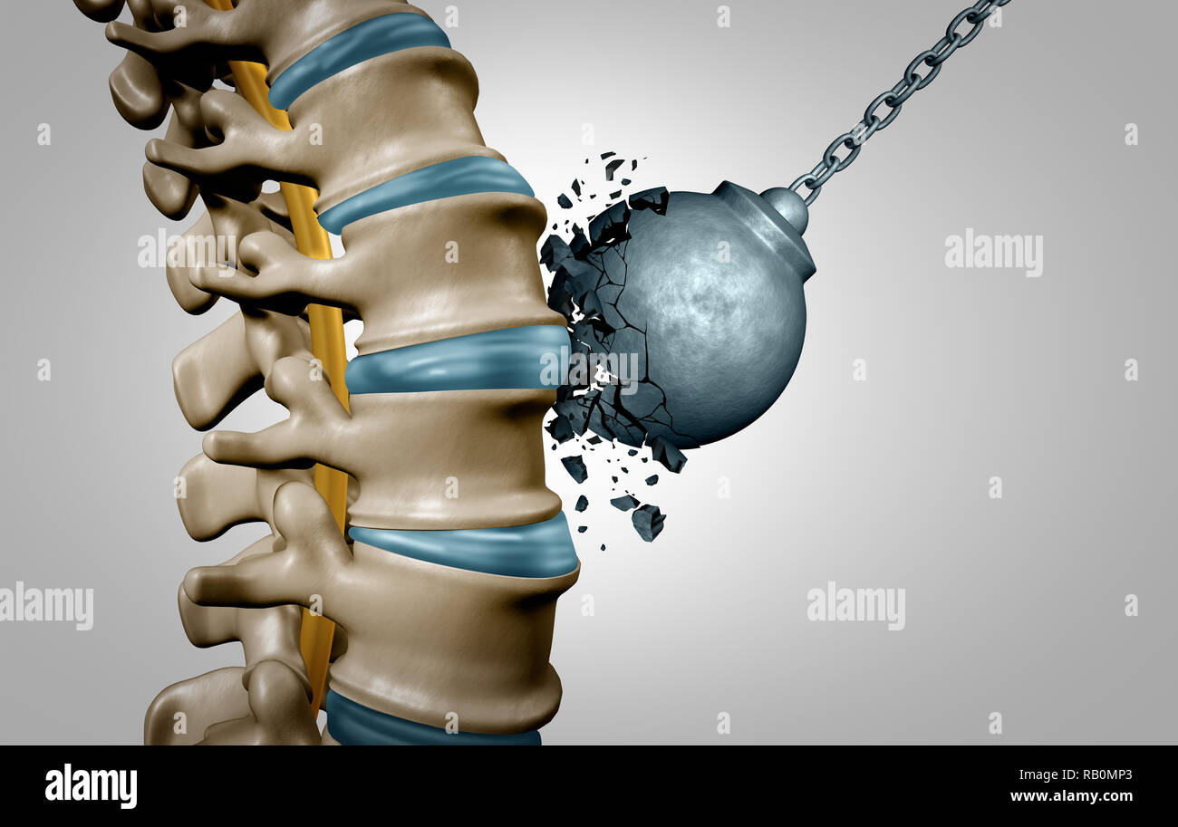 Intervertebral discs -Fotos und -Bildmaterial in hoher Auflösung – Alamy