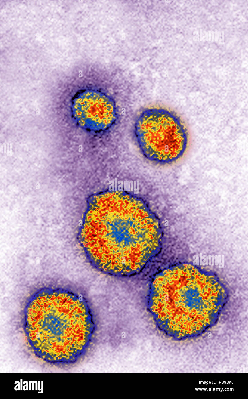 Mumps virus tem -Fotos und -Bildmaterial in hoher Auflösung – Alamy
