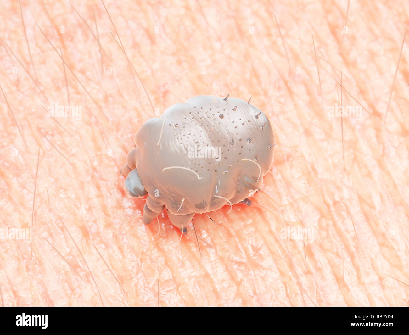 Ausschlag Milben Stockfotos und -bilder Kaufen - Alamy