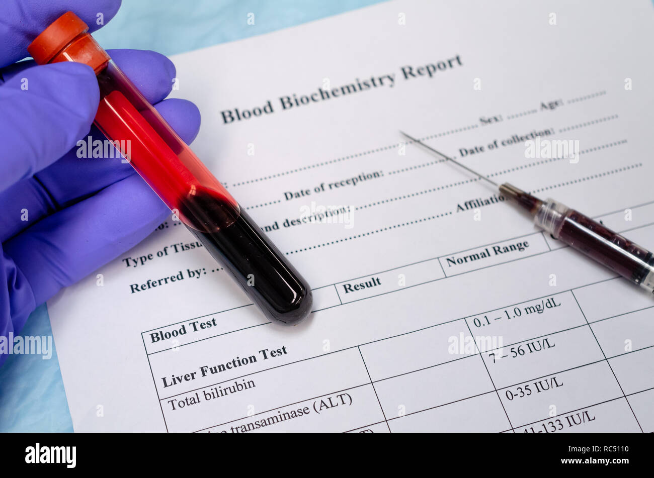 Blutentnahme für die biochemische Analyse von Blut bei ...
