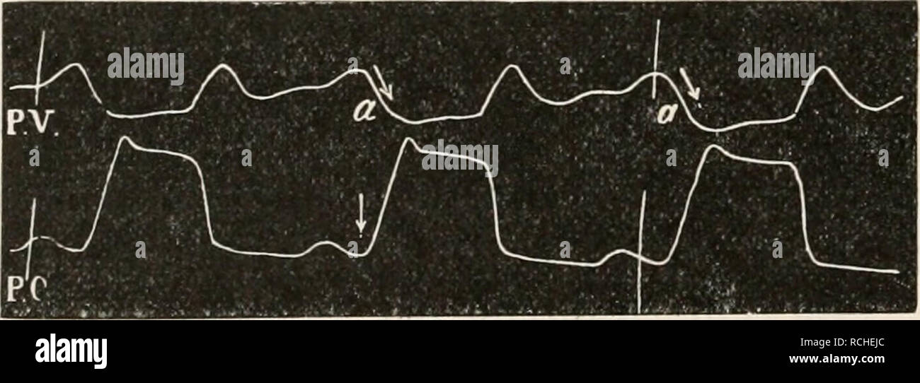 . Die Physiologie des Kreislaufes. Herz-kreislauf-System. Abb. 472 ...