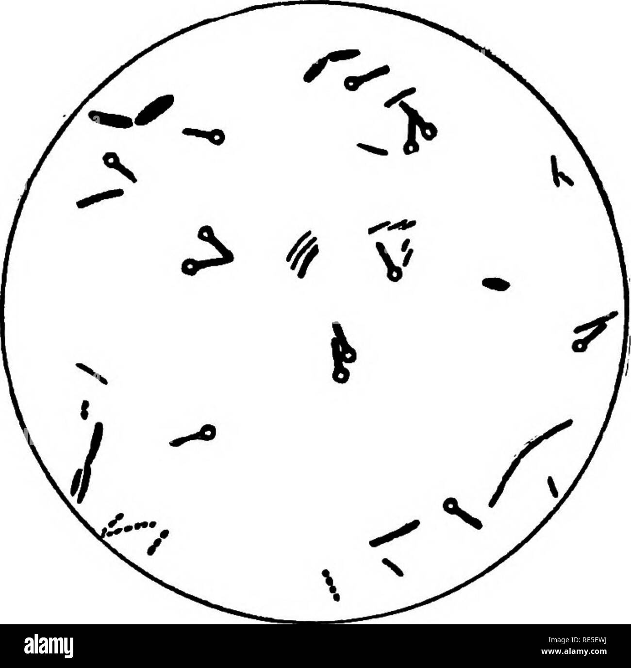 Tetanus Lockjaw Stockfotos und -bilder Kaufen - Alamy