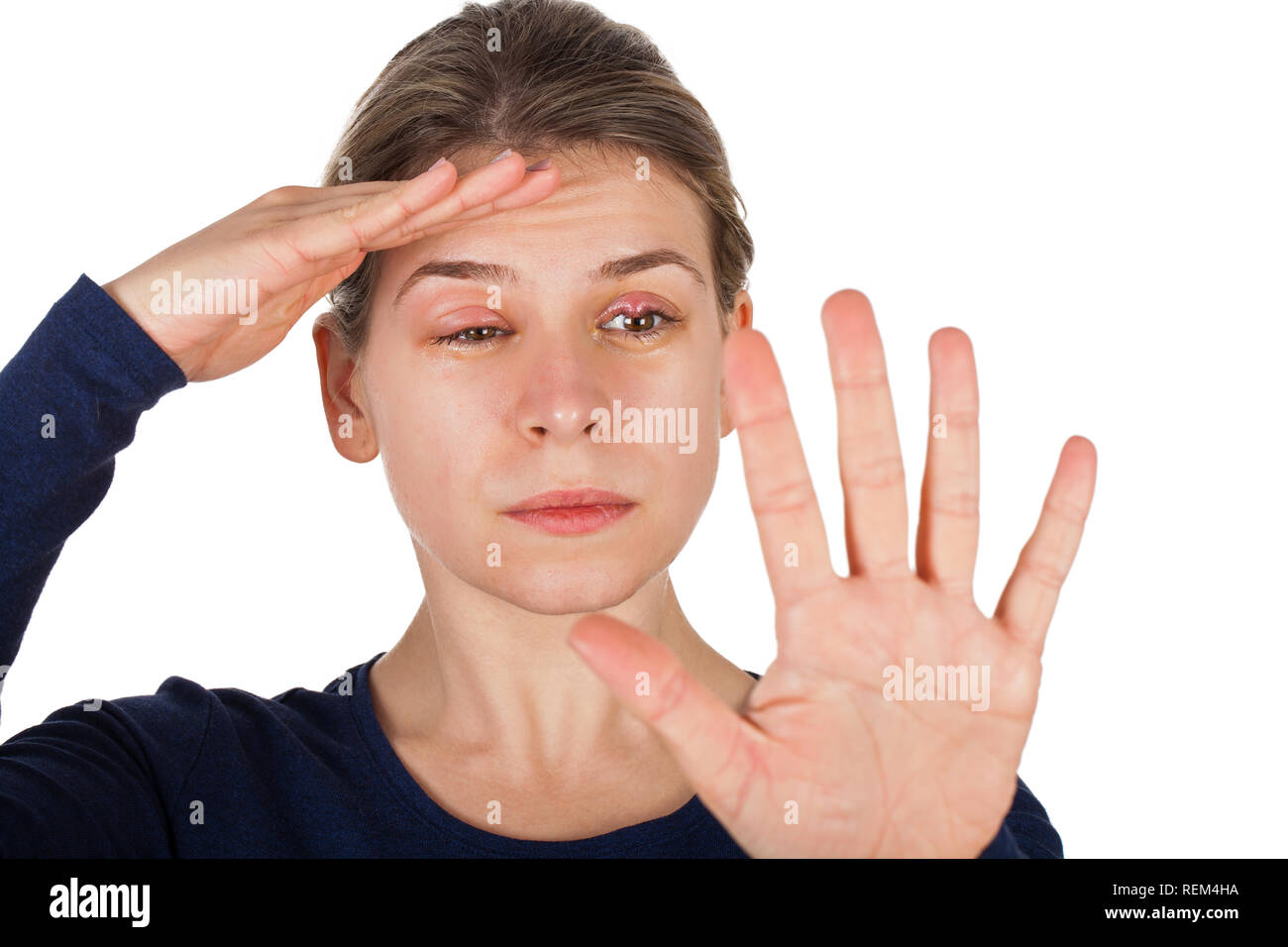 Eitrige konjunktivitis -Fotos und -Bildmaterial in hoher Auflösung – Alamy
