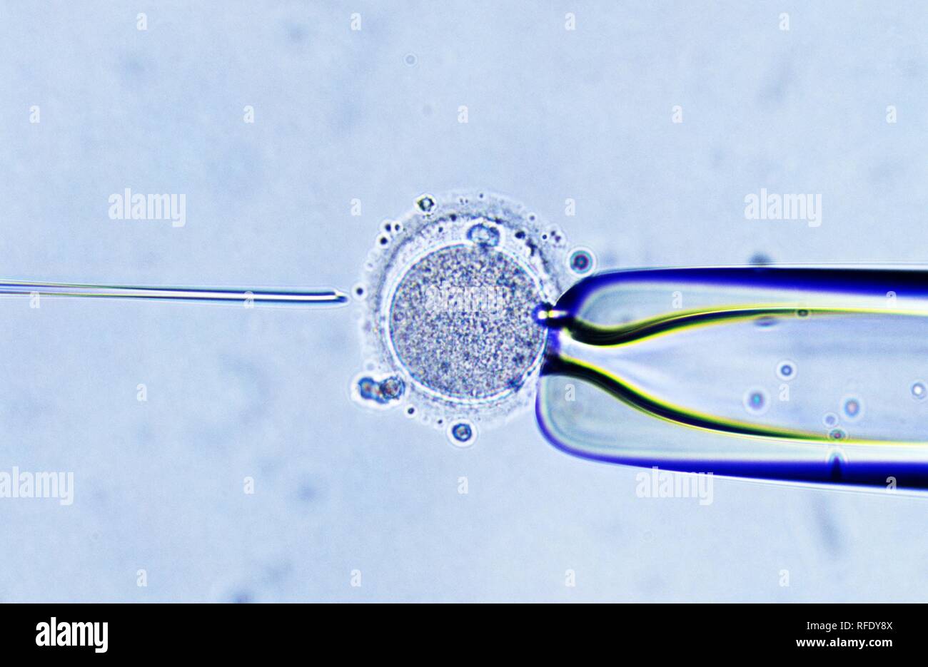 In-vitro-Fertilisation, Injektion von einem Spermium in die Eizelle ...