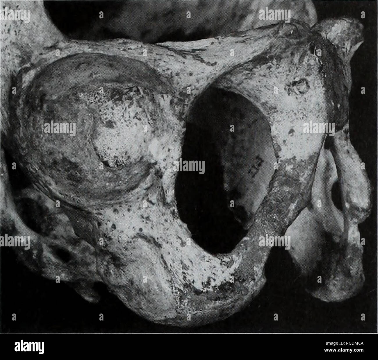 Ischio pubic ramus -Fotos und -Bildmaterial in hoher Auflösung – Alamy