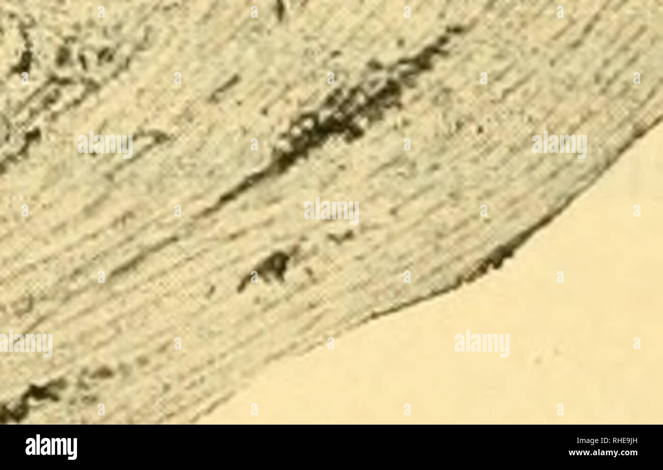 Ernia inguinale -Fotos und -Bildmaterial in hoher Auflösung – Alamy