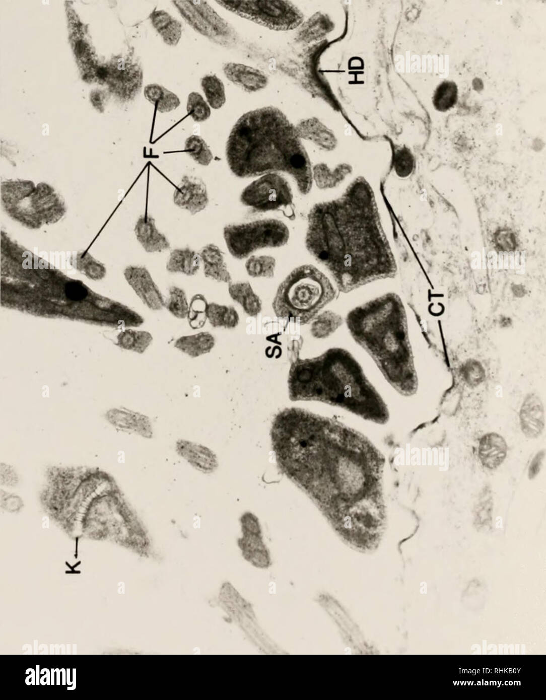 Leishmaniose mensch -Fotos und -Bildmaterial in hoher Auflösung – Alamy