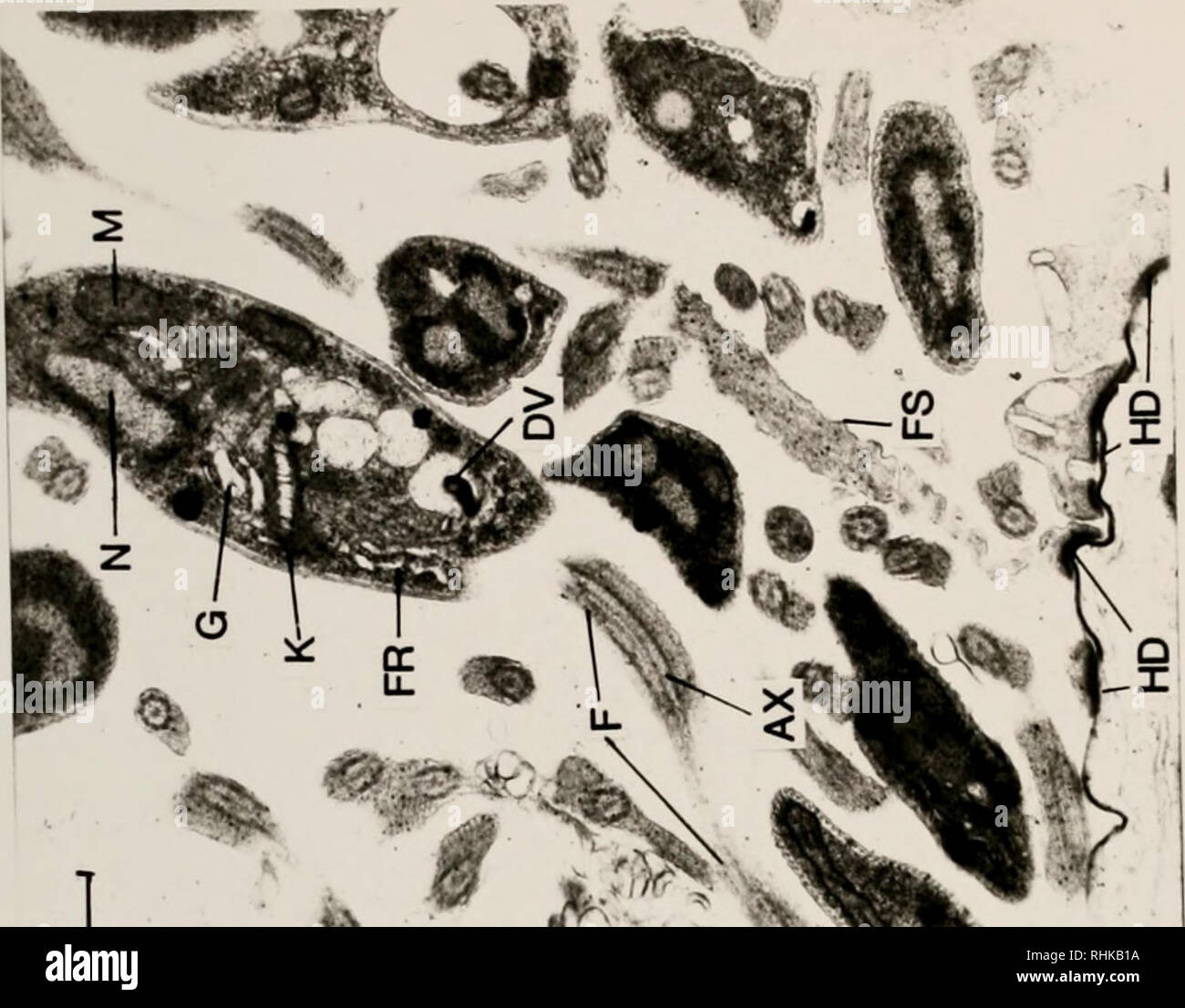 Leishmaniose mensch -Fotos und -Bildmaterial in hoher Auflösung – Alamy