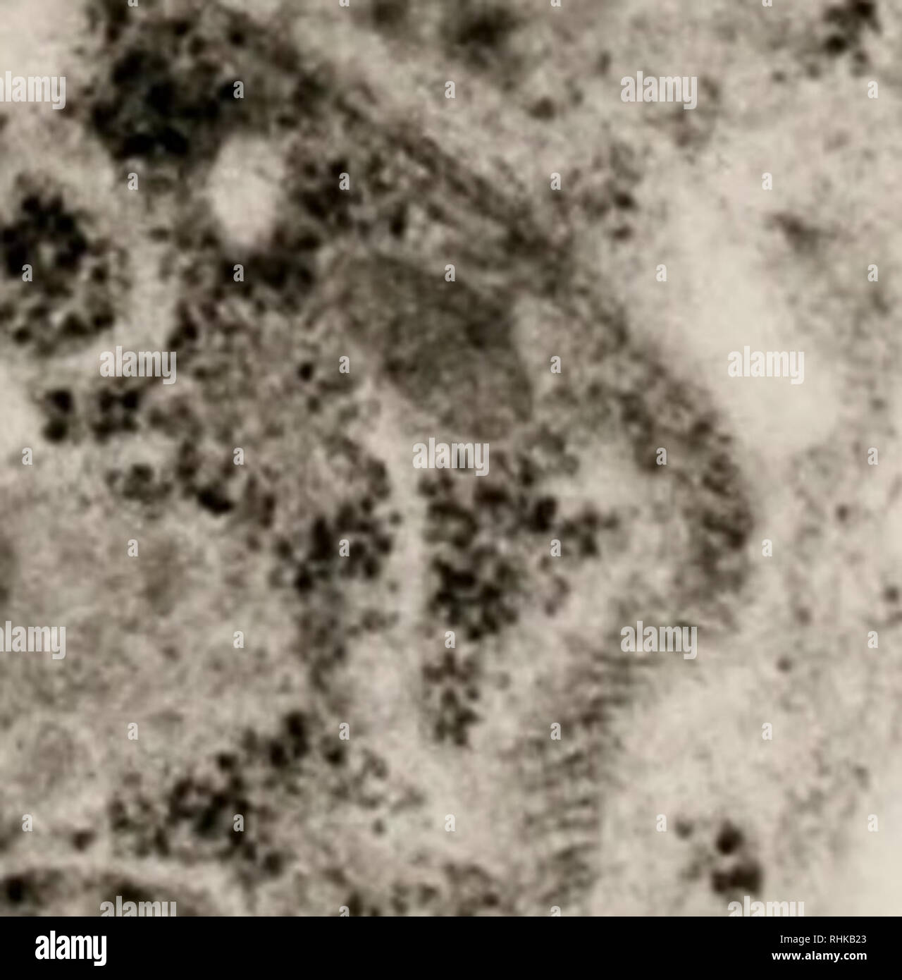 Leishmaniose mensch -Fotos und -Bildmaterial in hoher Auflösung – Alamy