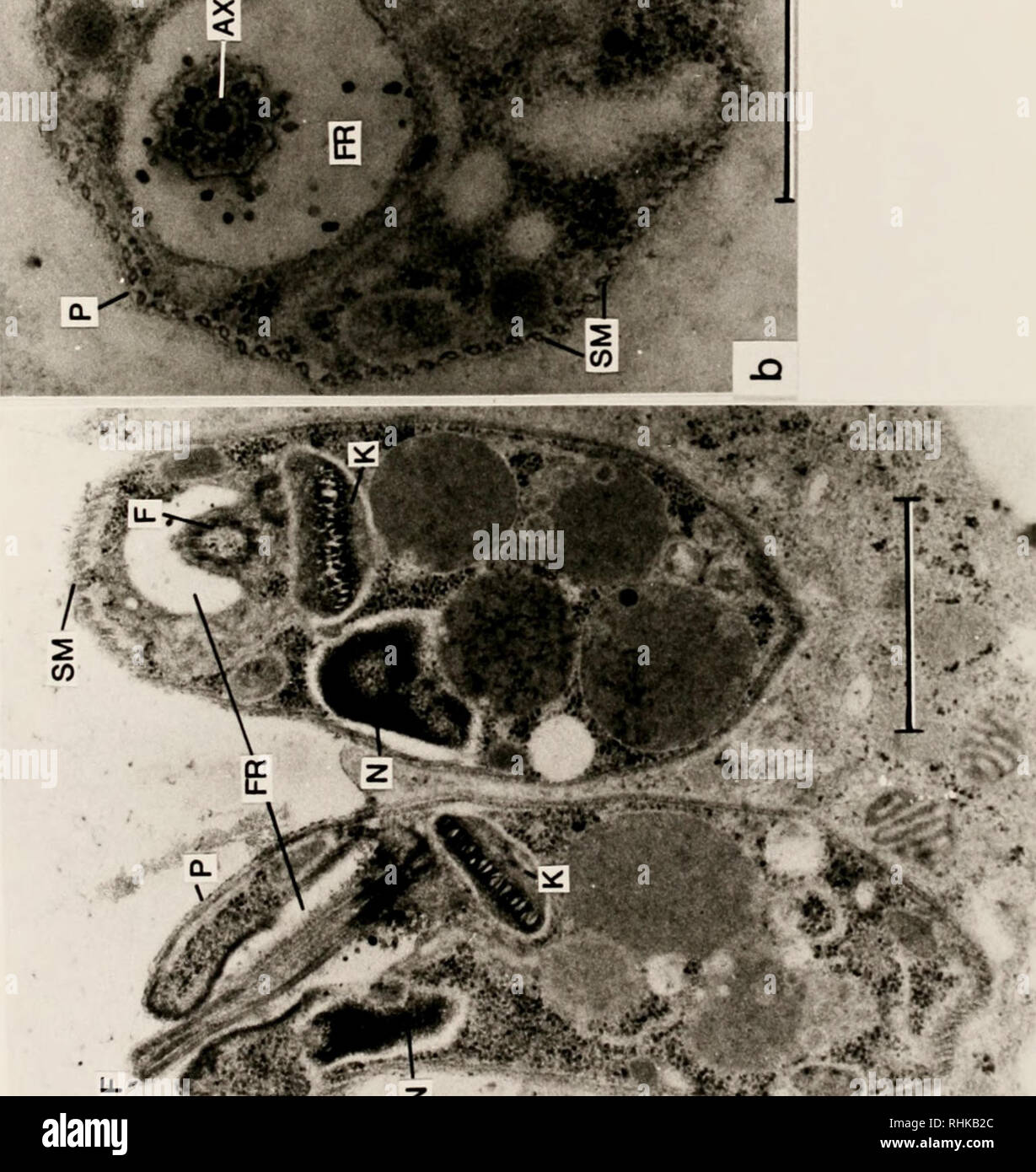 Leishmaniose mensch -Fotos und -Bildmaterial in hoher Auflösung – Alamy