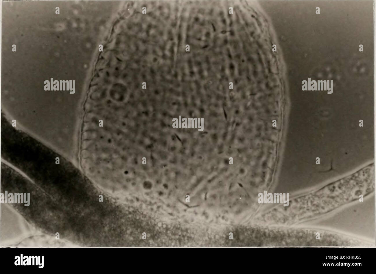 Leishmaniose mensch -Fotos und -Bildmaterial in hoher Auflösung – Alamy