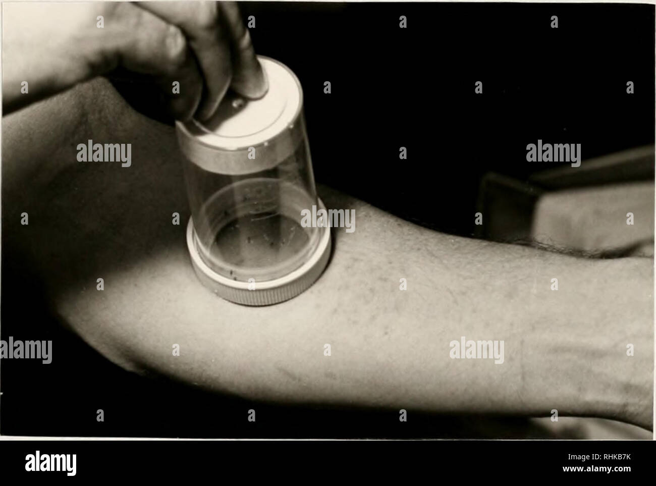 Leishmaniose mensch -Fotos und -Bildmaterial in hoher Auflösung – Alamy