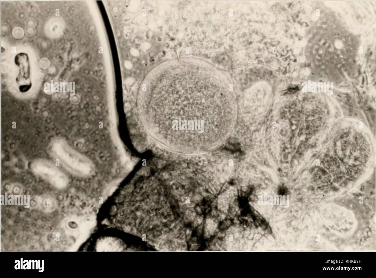 Leishmaniose mensch -Fotos und -Bildmaterial in hoher Auflösung – Alamy