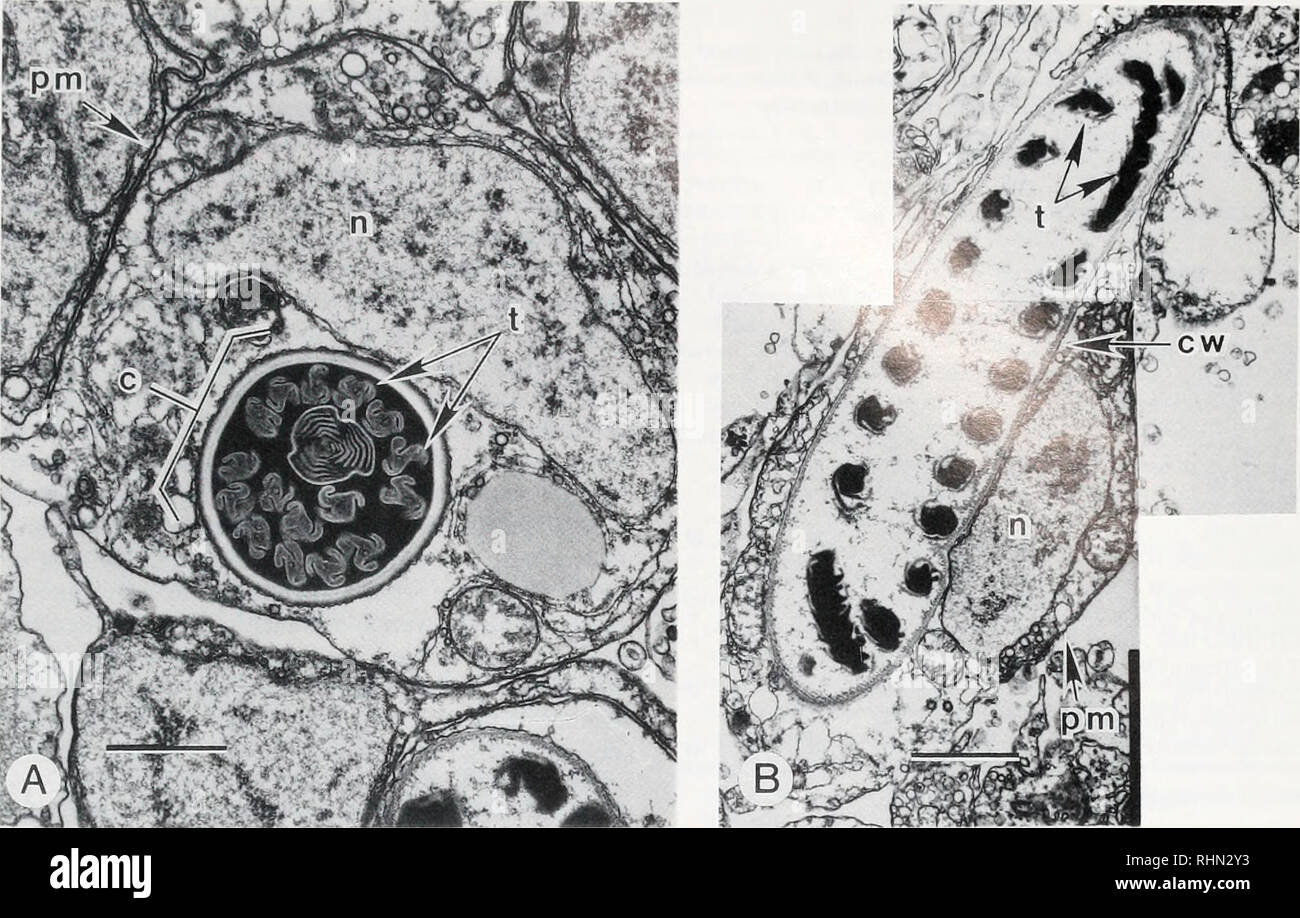 T tubulus -Fotos und -Bildmaterial in hoher Auflösung – Alamy