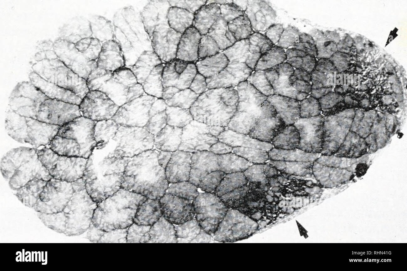 Stomatogastrisches ganglion -Fotos und -Bildmaterial in hoher Auflösung ...