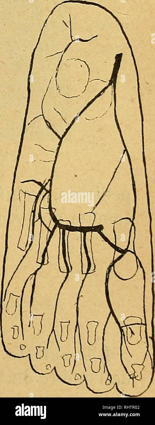 Anatomie du pied -Fotos und -Bildmaterial in hoher Auflösung – Alamy
