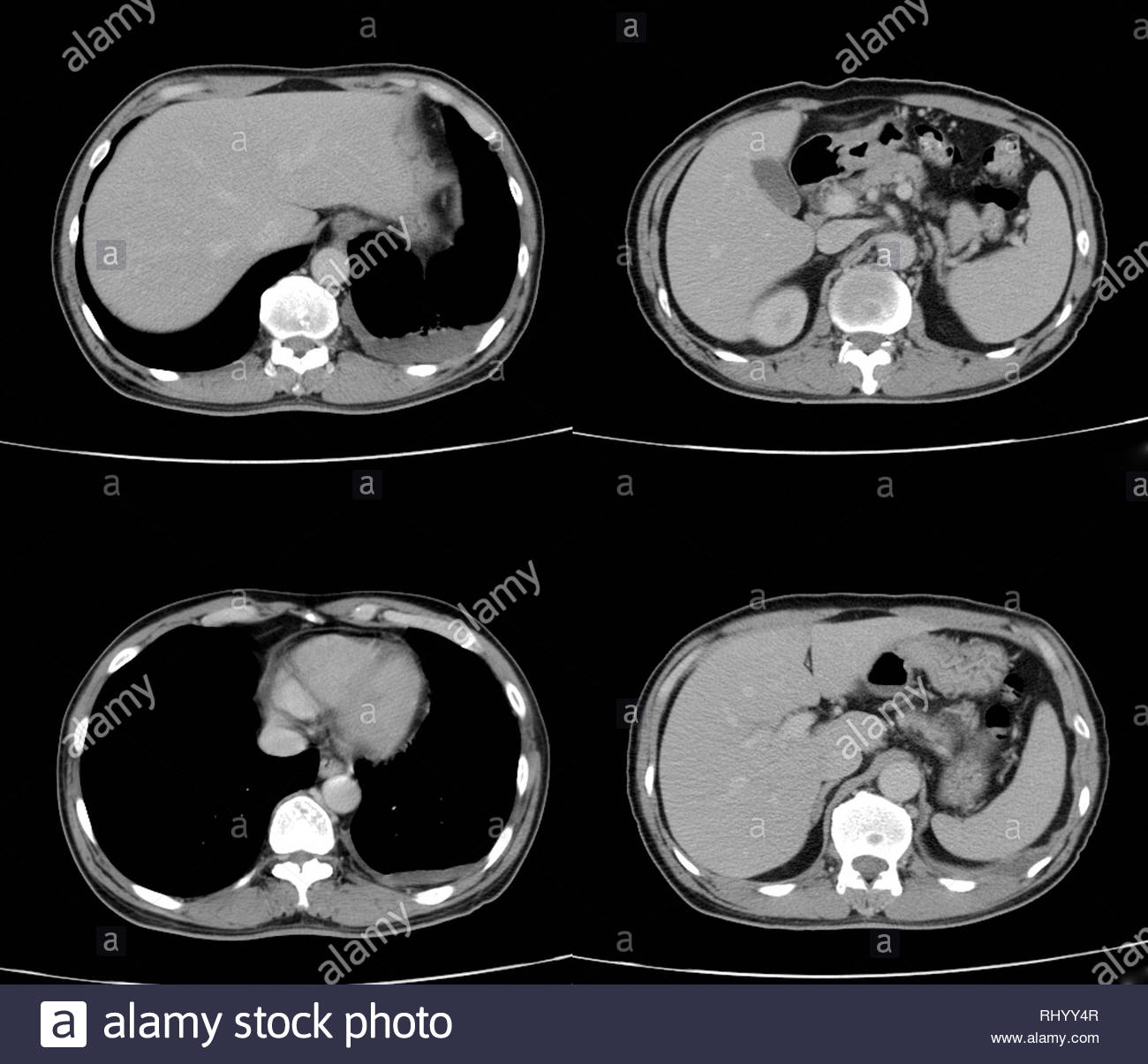 Axial Mri Stockfotos & Axial Mri Bilder - Alamy