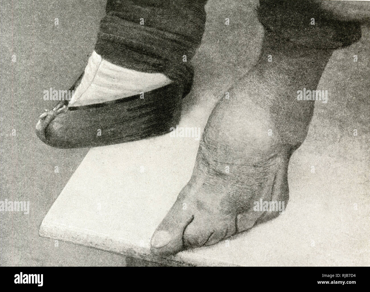 Bound Feet China Stockfotos und -bilder Kaufen - Alamy