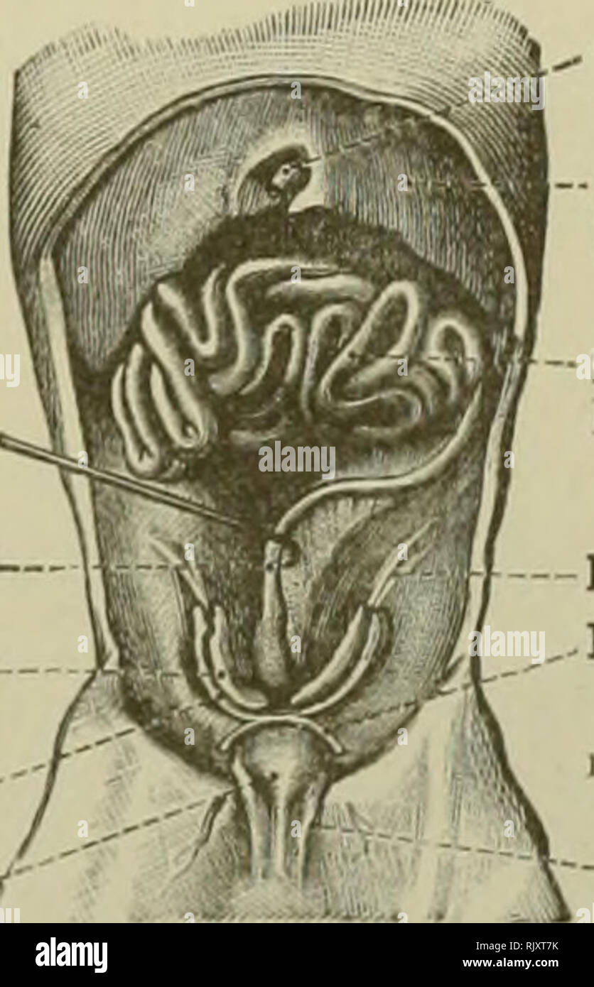 Ligamentum Inguinale Stockfotos & Ligamentum Inguinale Bilder - Alamy