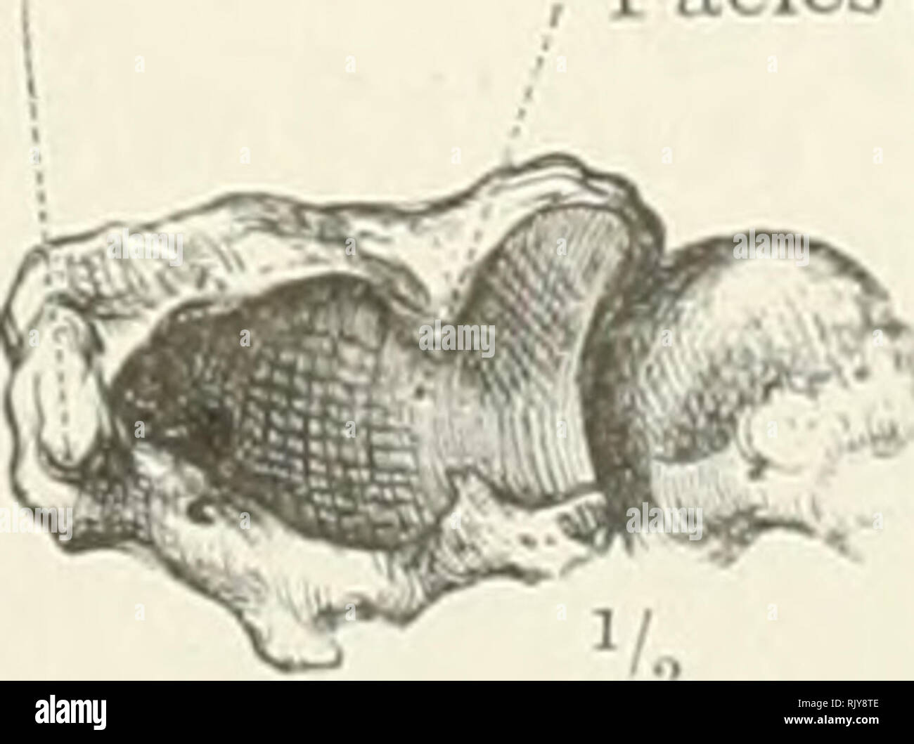 Processus styloideus radii -Fotos und -Bildmaterial in hoher Auflösung ...