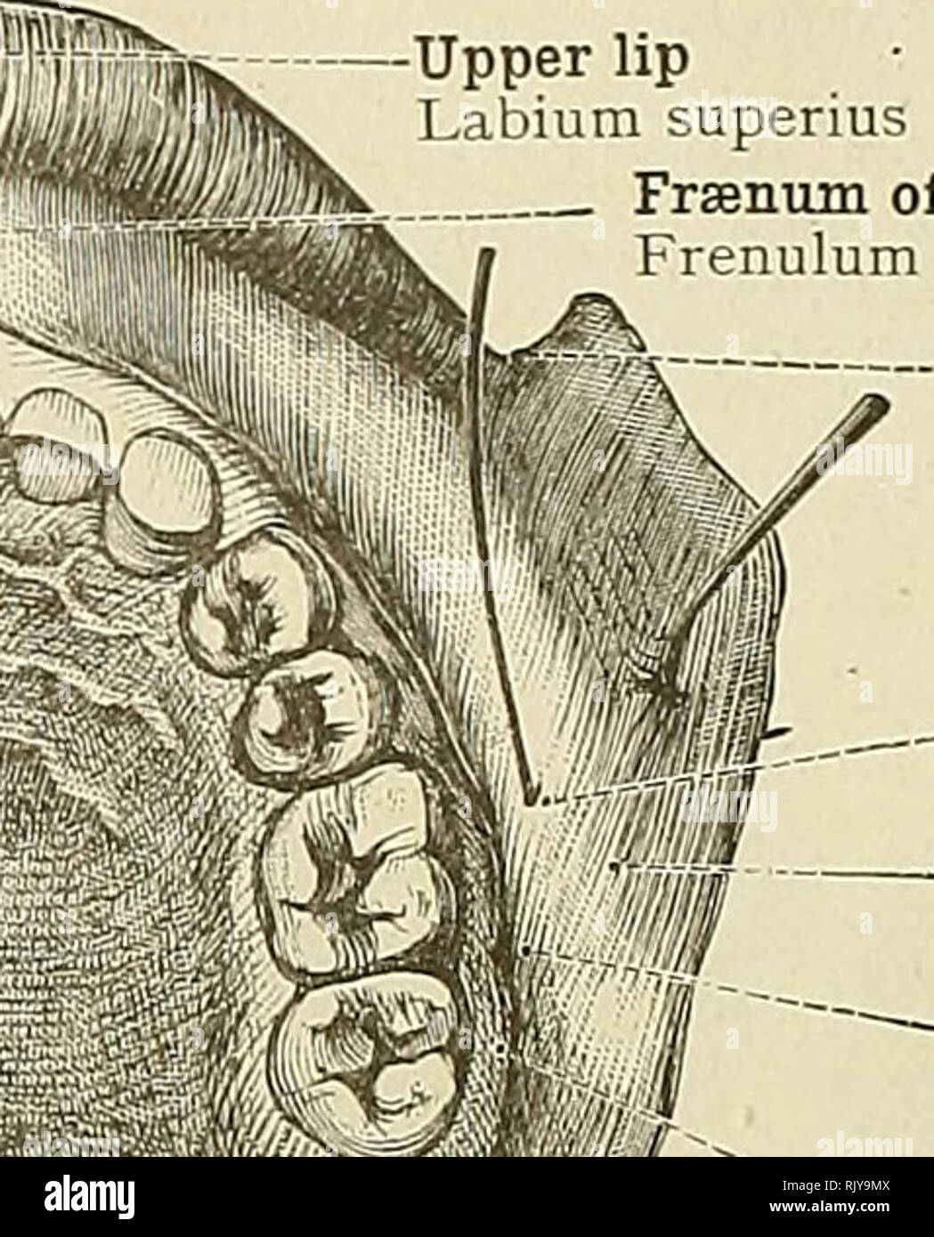 Velum Palatinum Elements Of Morphology: Human Malformation Terminology