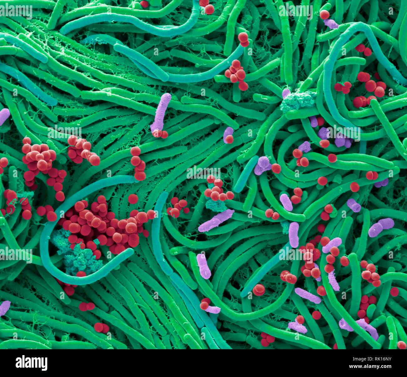 Prokaryotic cell micrograph -Fotos und -Bildmaterial in hoher Auflösung ...