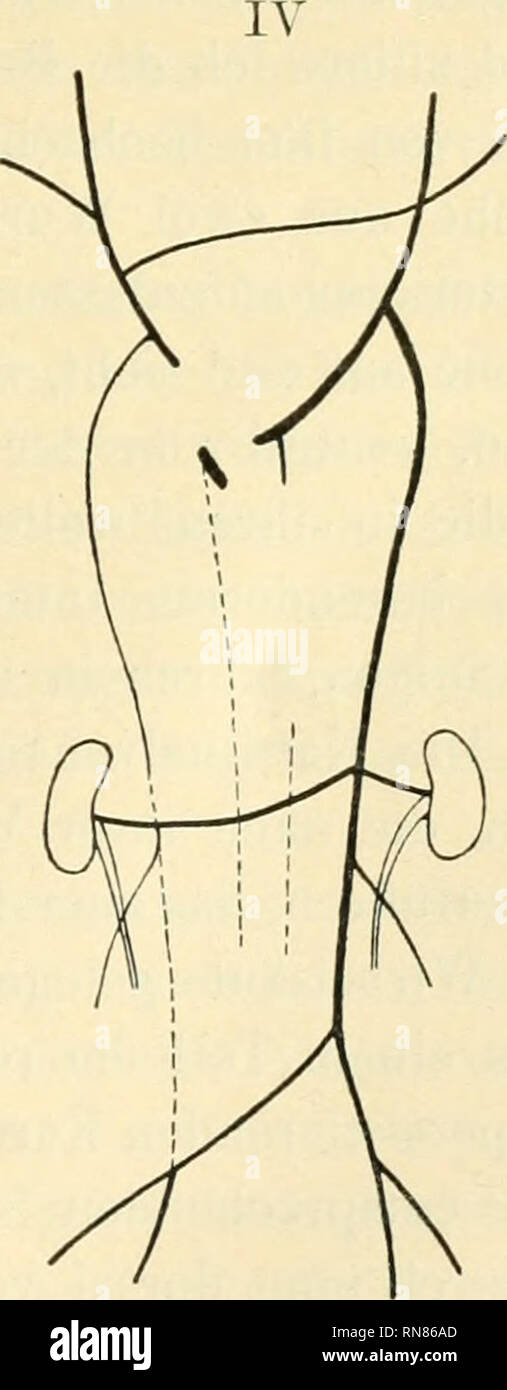Vena iliaca externa -Fotos und -Bildmaterial in hoher Auflösung – Alamy