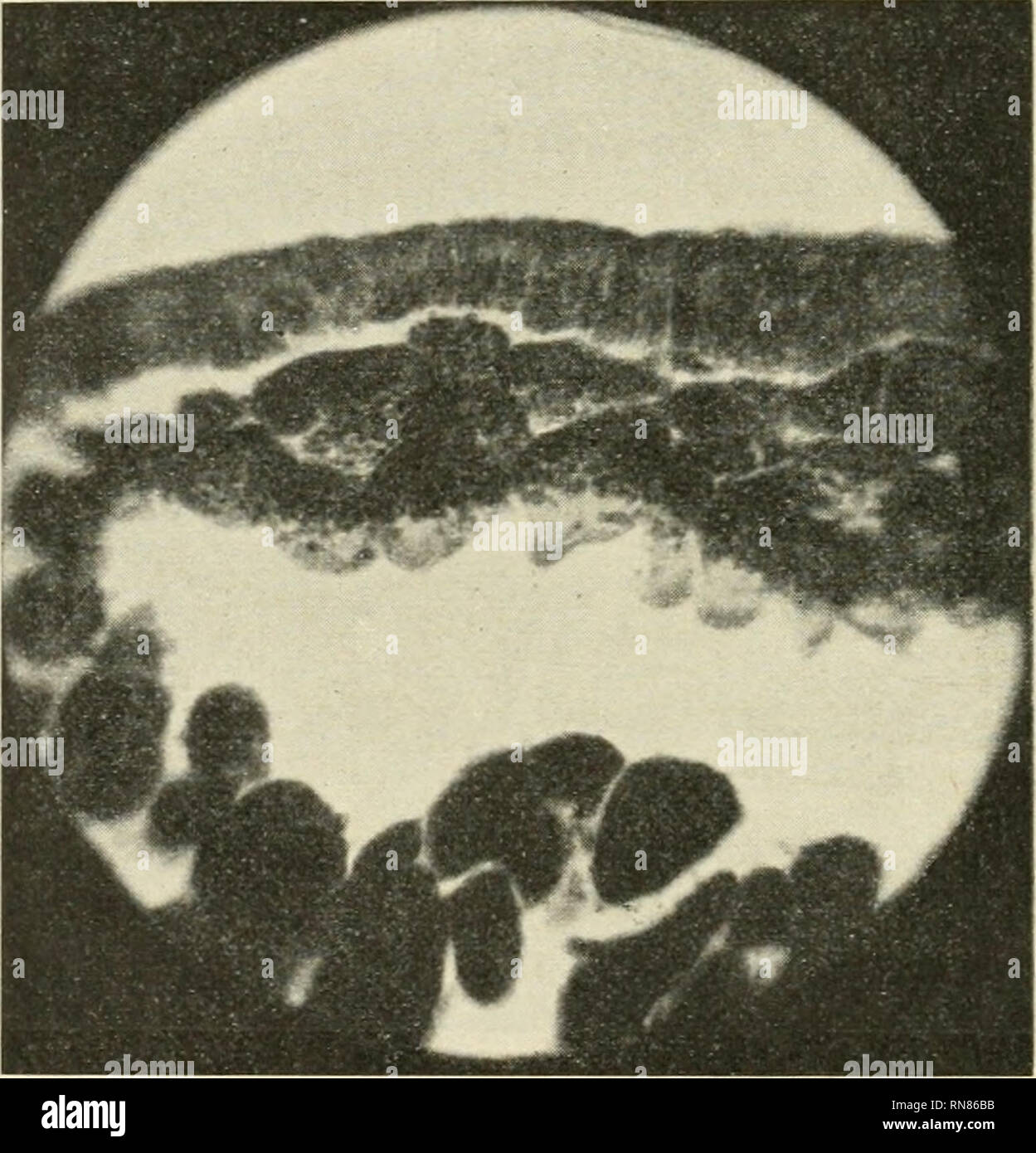 Anatomia de la superficie -Fotos und -Bildmaterial in hoher Auflösung ...