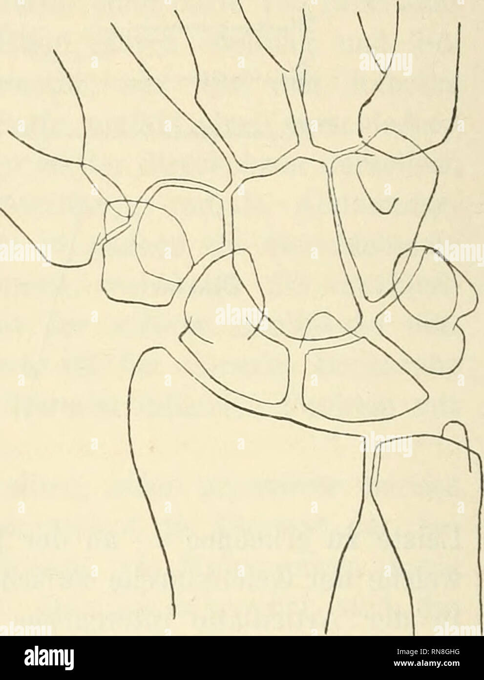 Processus styloideus radii -Fotos und -Bildmaterial in hoher Auflösung ...