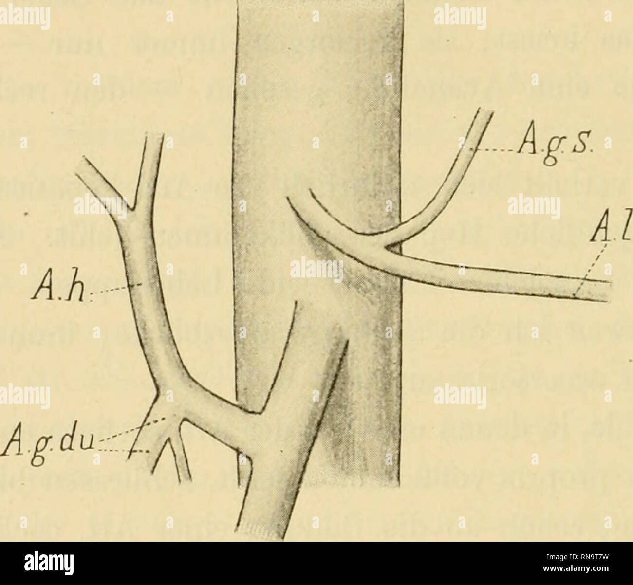 Arteria gastroduodenalis -Fotos und -Bildmaterial in hoher Auflösung ...