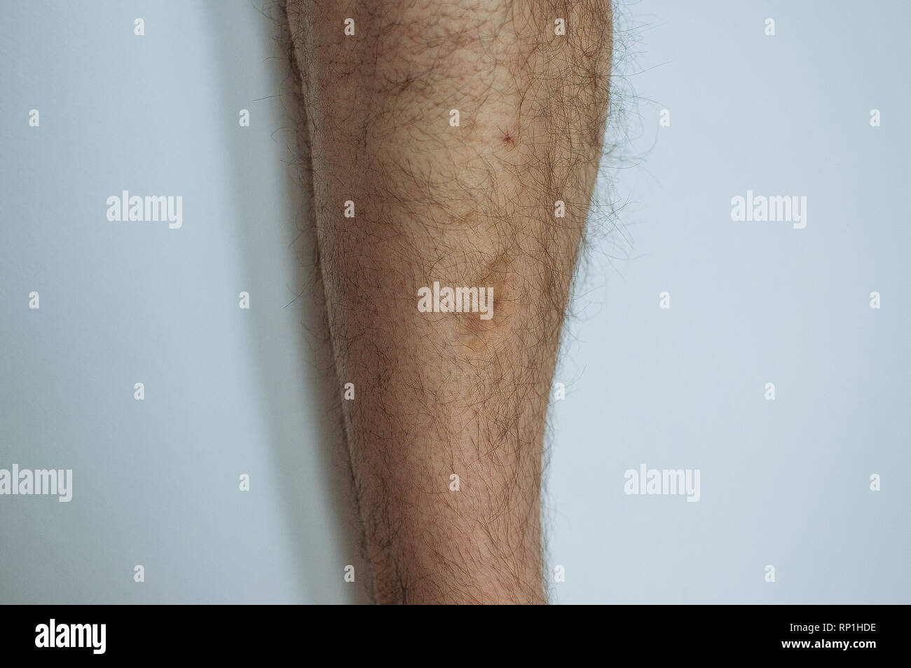 Das narbenprojekt -Fotos und -Bildmaterial in hoher Auflösung – Alamy