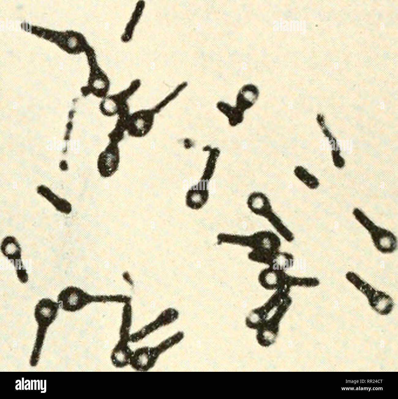 Tetanus Bacillus Stockfotos & Tetanus Bacillus Bilder - Alamy