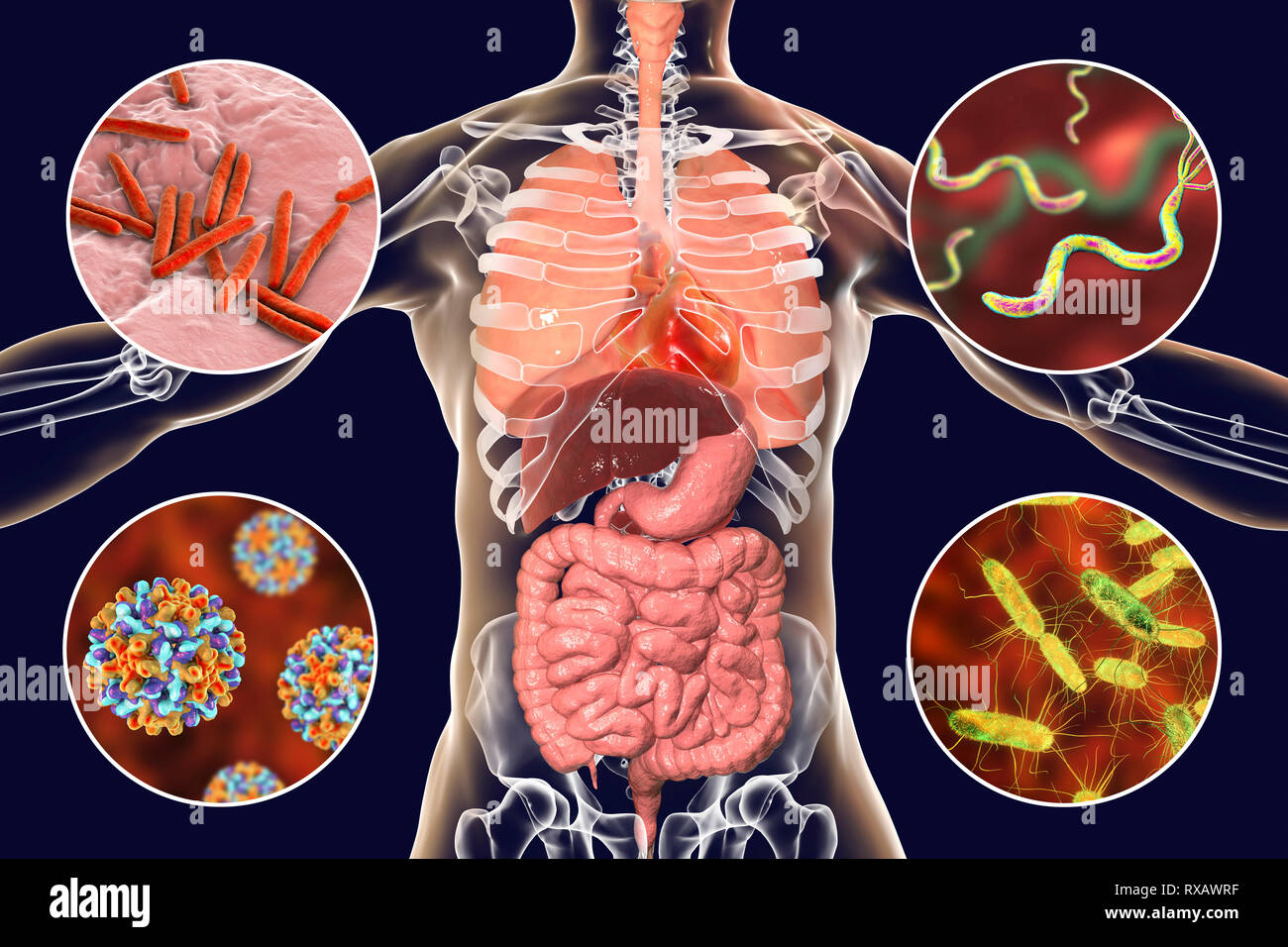 Infektionen beim menschen -Fotos und -Bildmaterial in hoher Auflösung ...