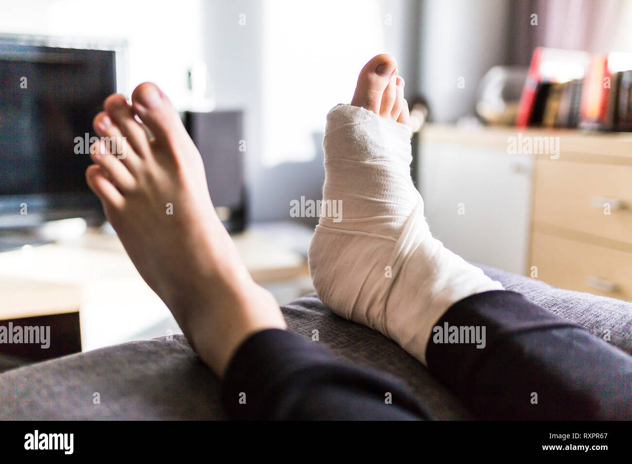 Bein Im Gipsverband Stockfotos & Bein Im Gipsverband Bilder - Alamy
