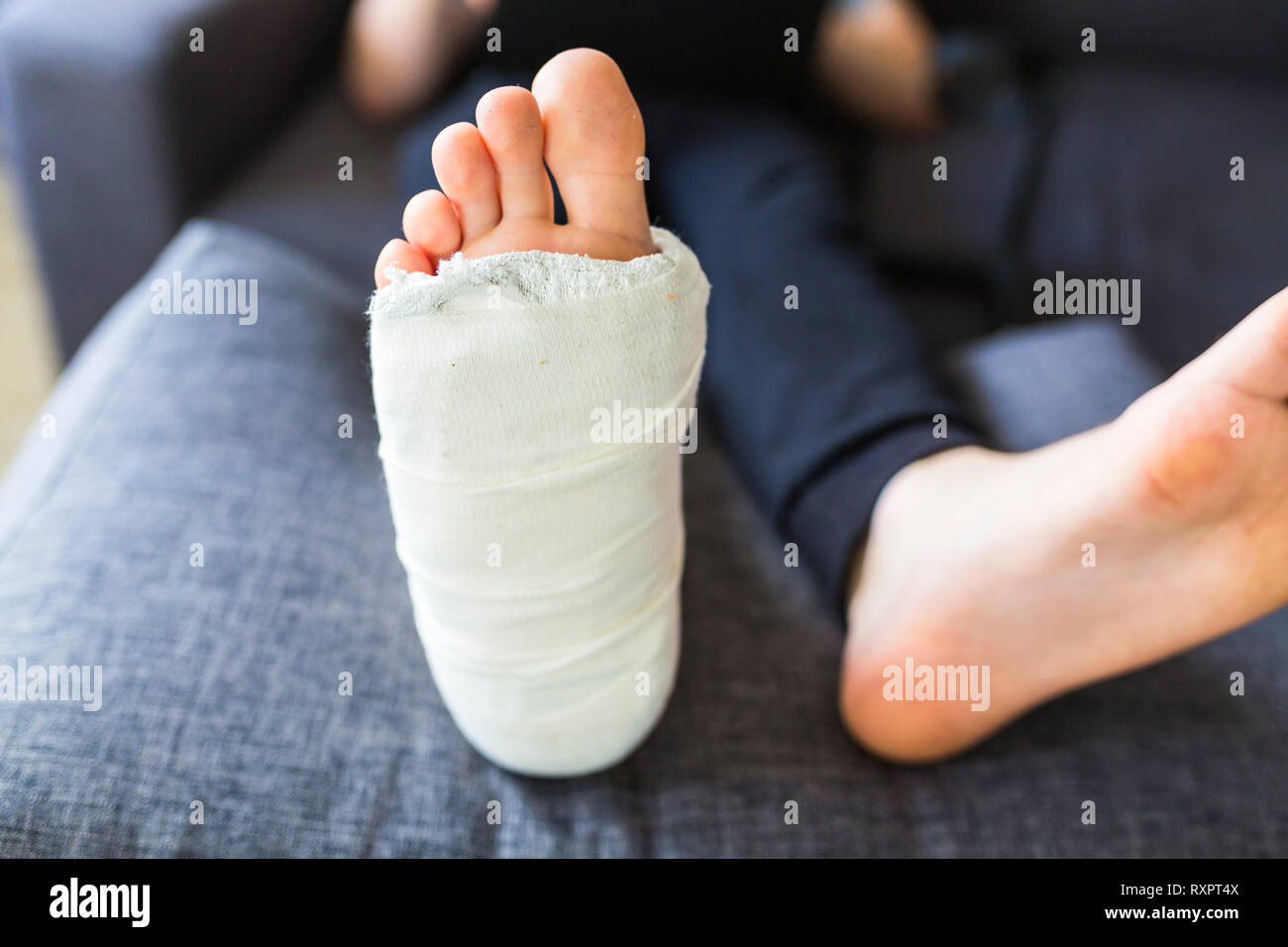 Broken leg cast -Fotos und -Bildmaterial in hoher Auflösung – Alamy