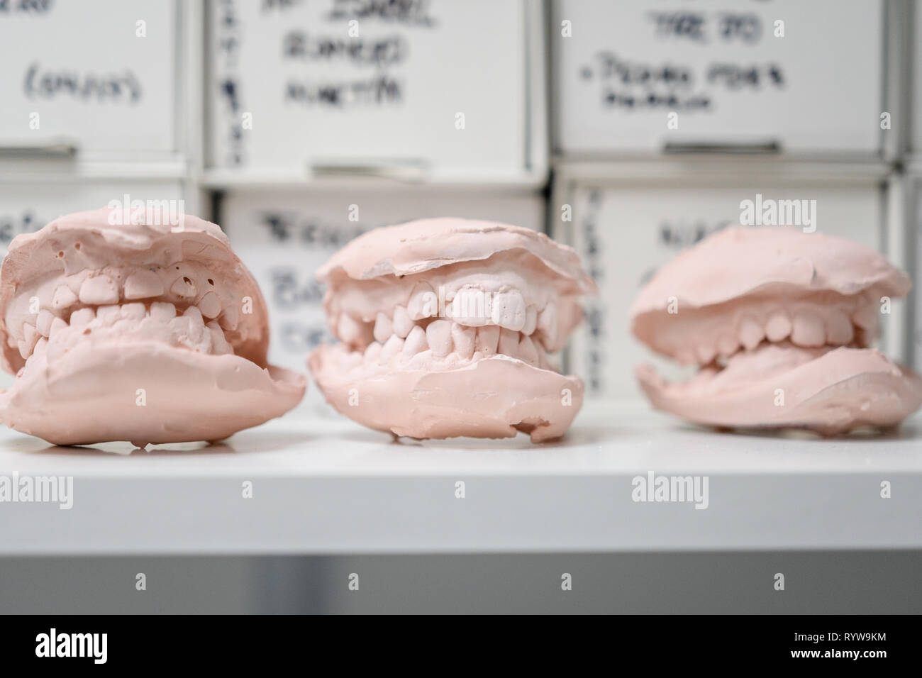Mandibular teeth human -Fotos und -Bildmaterial in hoher Auflösung – Alamy
