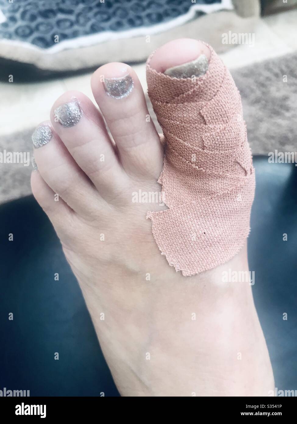 Fractured foot -Fotos und -Bildmaterial in hoher Auflösung – Alamy