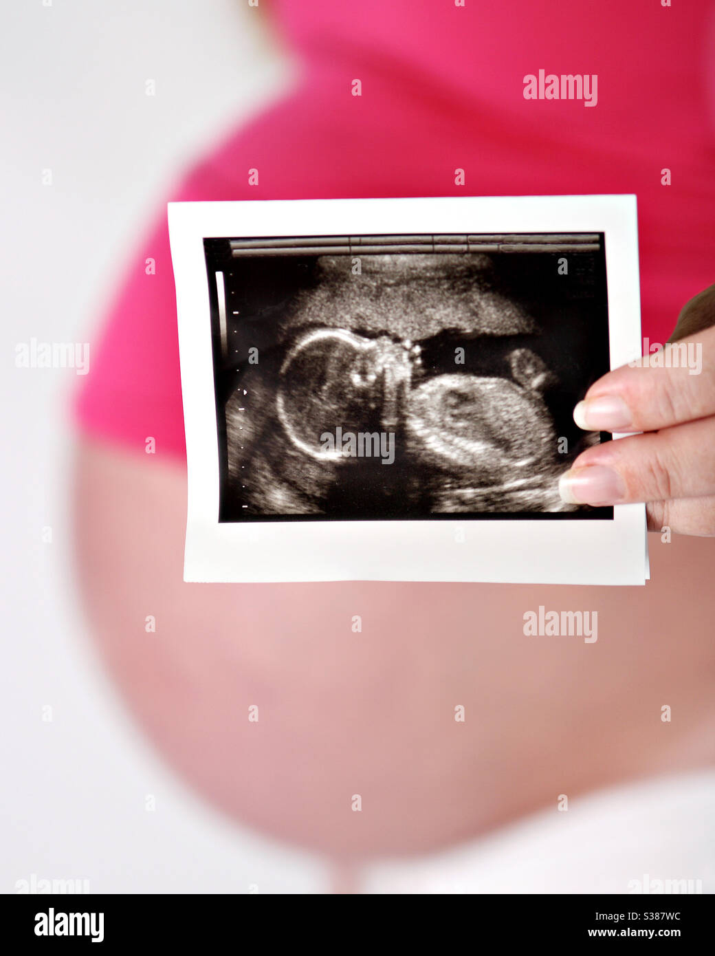 Fetus ultrasound -Fotos und -Bildmaterial in hoher Auflösung – Alamy