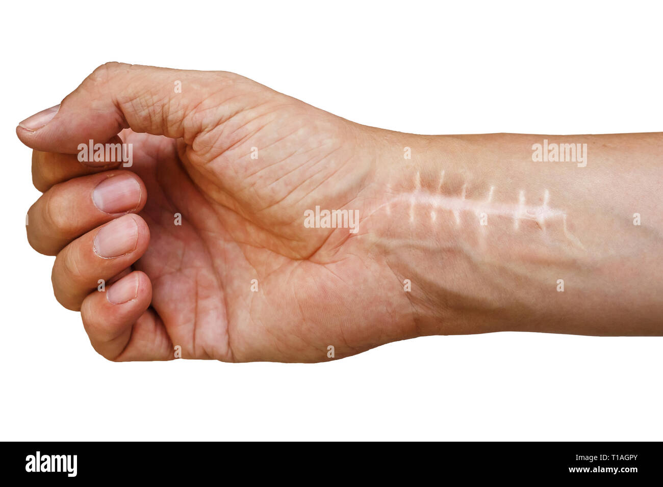 Operiere das glied -Fotos und -Bildmaterial in hoher Auflösung – Alamy