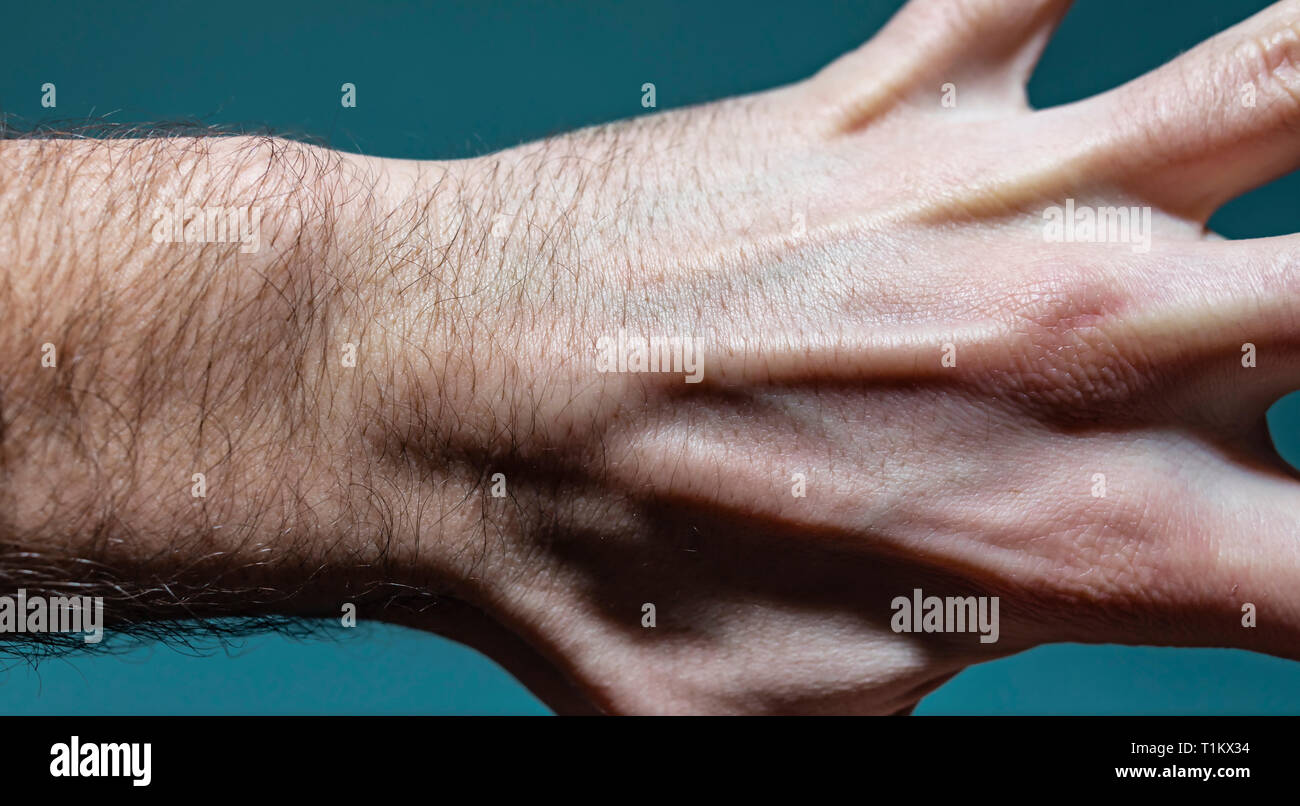 Dorsale digitale nerven -Fotos und -Bildmaterial in hoher Auflösung – Alamy