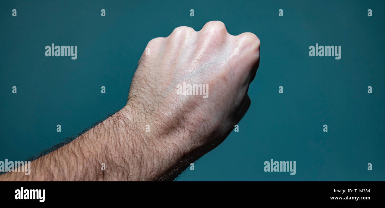 Ganglion cyst -Fotos und -Bildmaterial in hoher Auflösung – Alamy