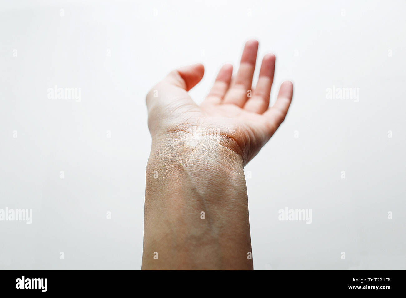 Weibliche hand mit einer Narbe auf weißem Hintergrund. alte Narbe am ...